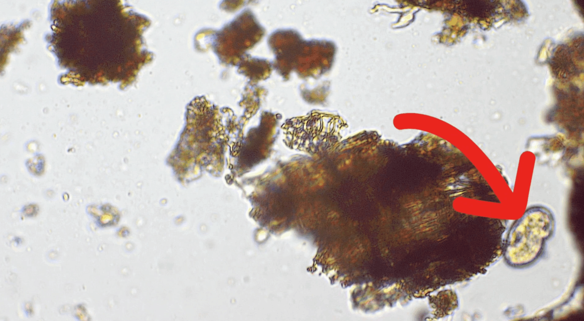 ILSR Contributes to Compost and Soil Contamination and Remediation ...