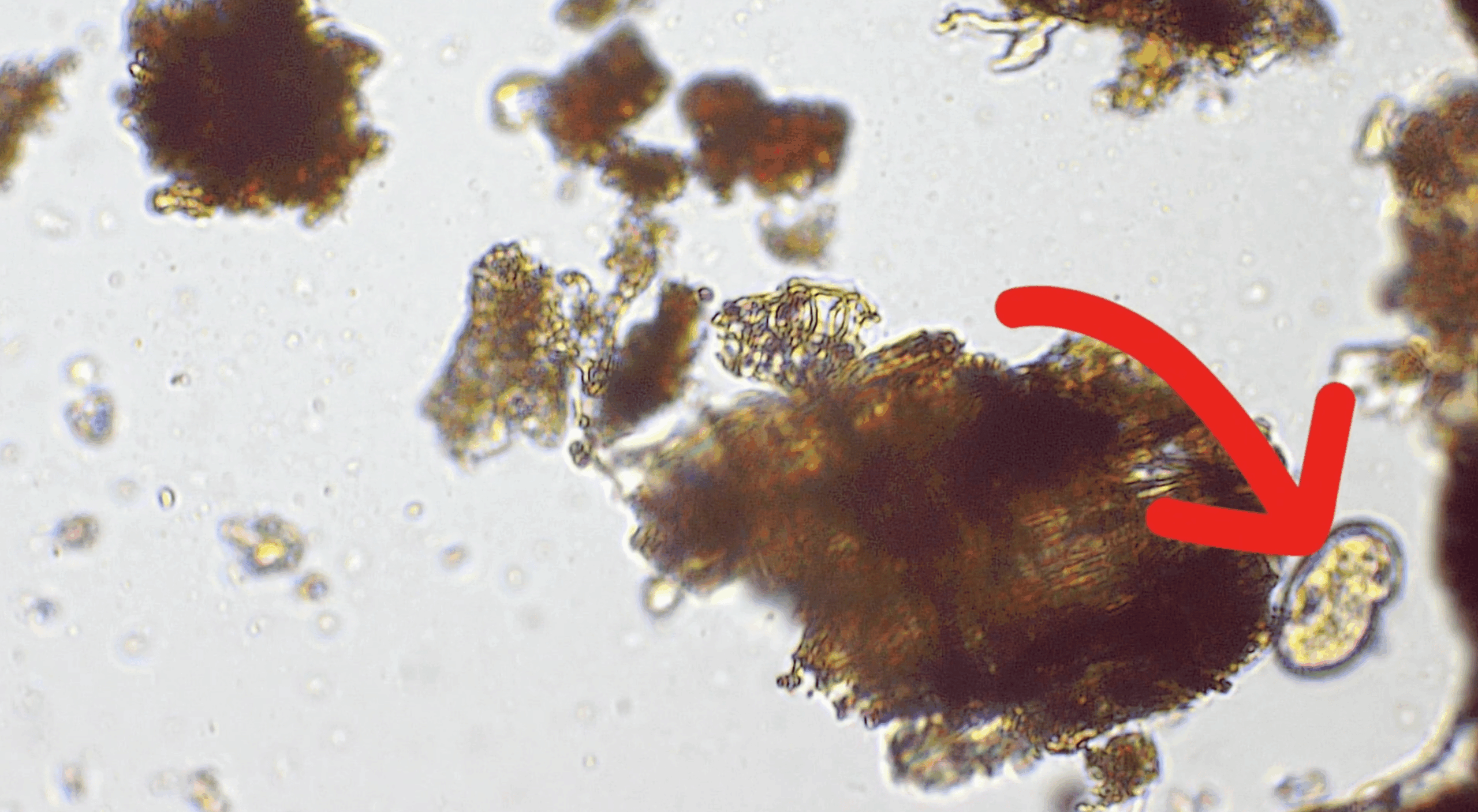 Compost and Soil Microscopy Mini-Course | Composting for Community